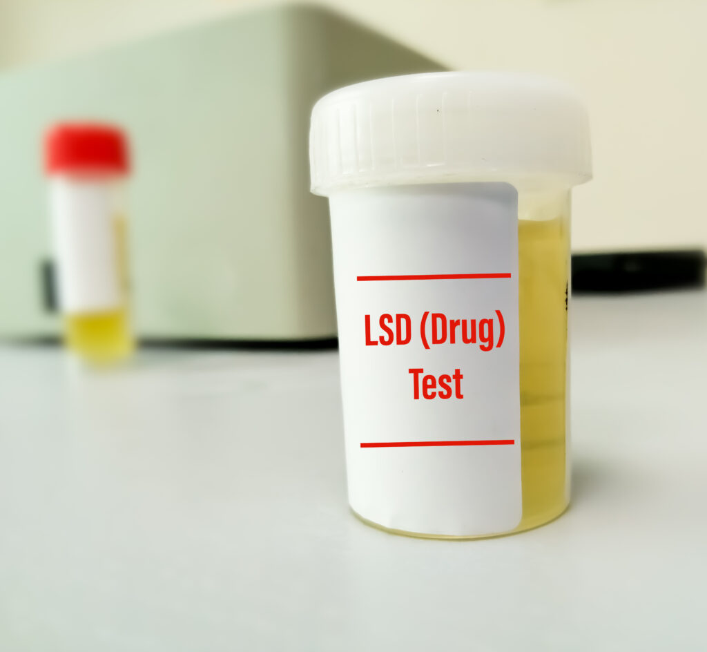 How Long Does LSD Take to Clear Your System?